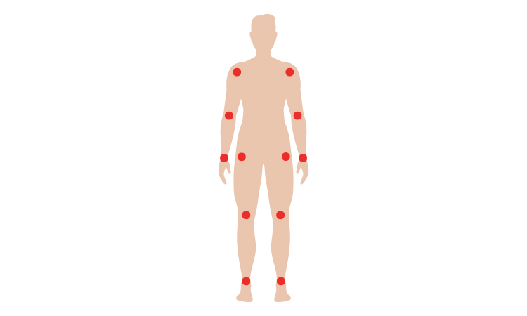 Rheumatoid Arthritis | Meijer Specialty Pharmacy